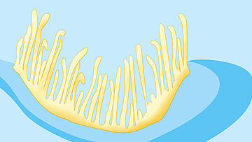 Berufskrankheit Lärmschwerhörigkeit - BGHW eMagazin